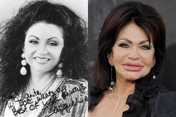 Plastic Surgery Fails To Keep You Up At Night