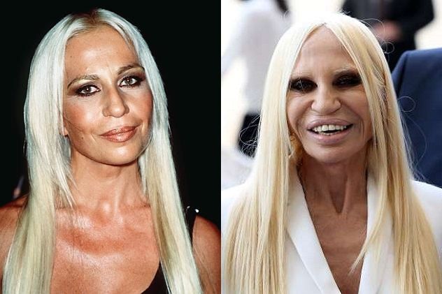 Plastic Surgery Fails To Keep You Up At Night