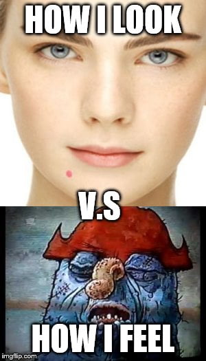10 Memes that Describe the Perils of Having Acne and Pimples!
