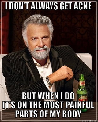 10 Memes that Describe the Perils of Having Acne and Pimples!
